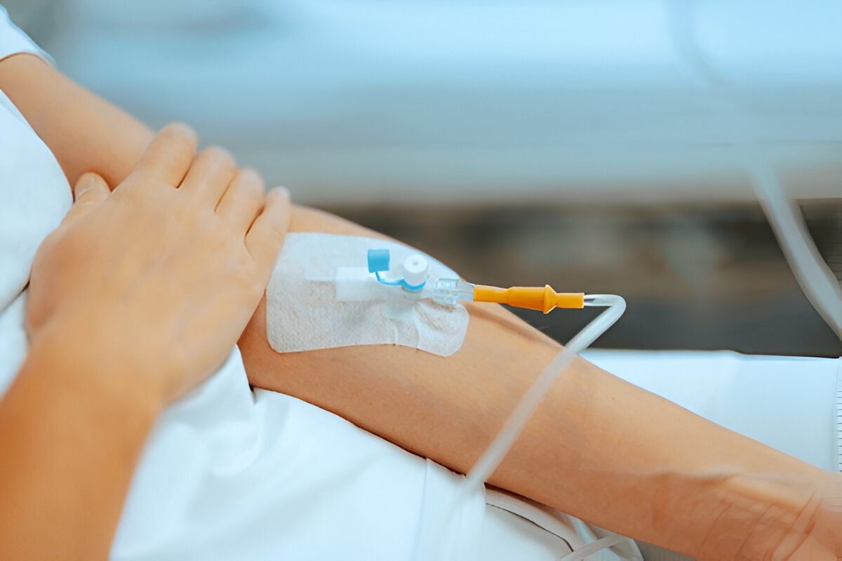 IV Sedation in Redwood City, CA | IV Sedation Near You